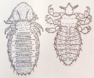 Types of Lice - LiceBoss