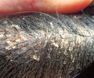 Monitor for Lice in Cattle - LiceBoss